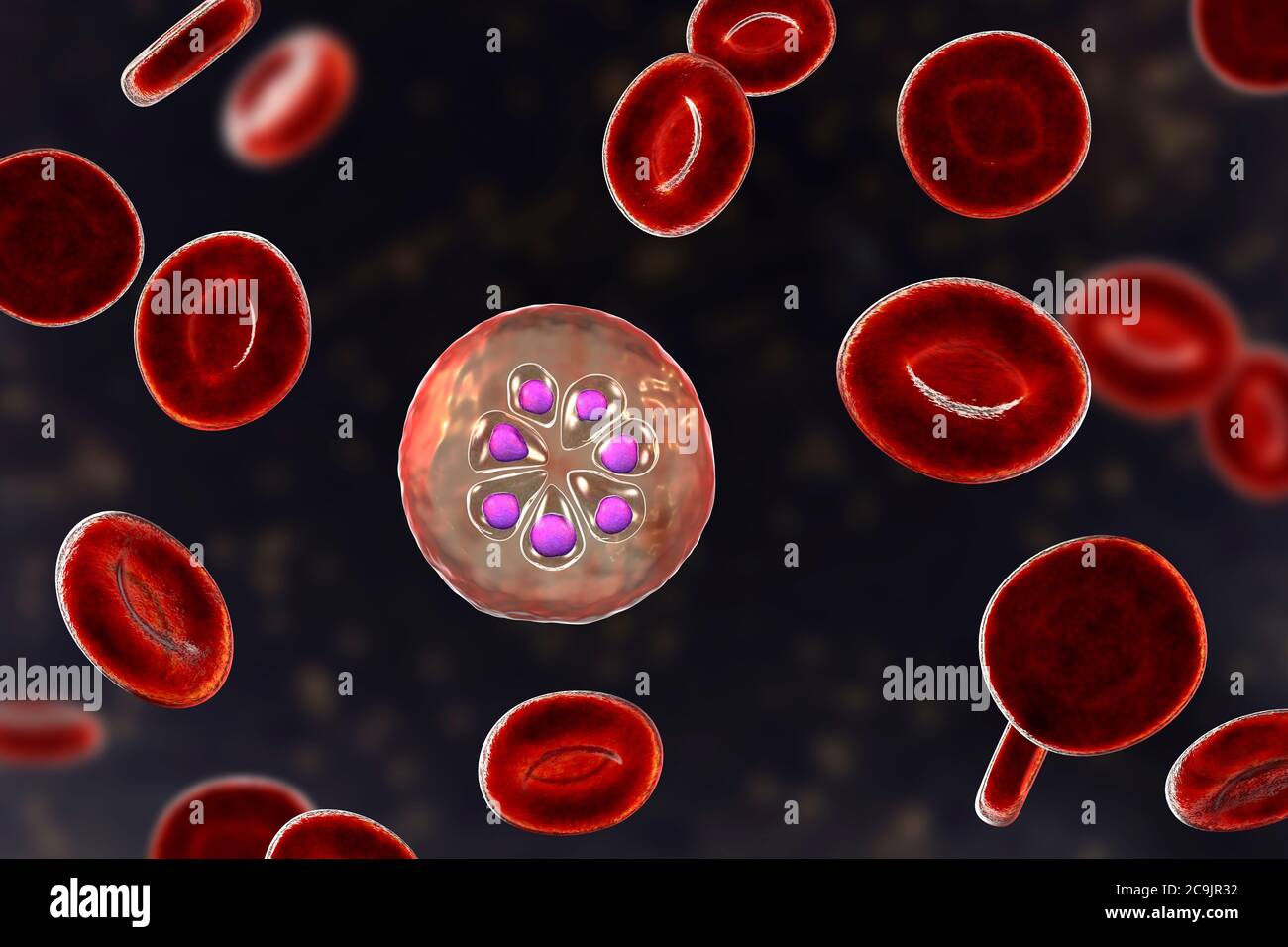 Plasmodium malariae protozoan inside red blood cells, computer ...