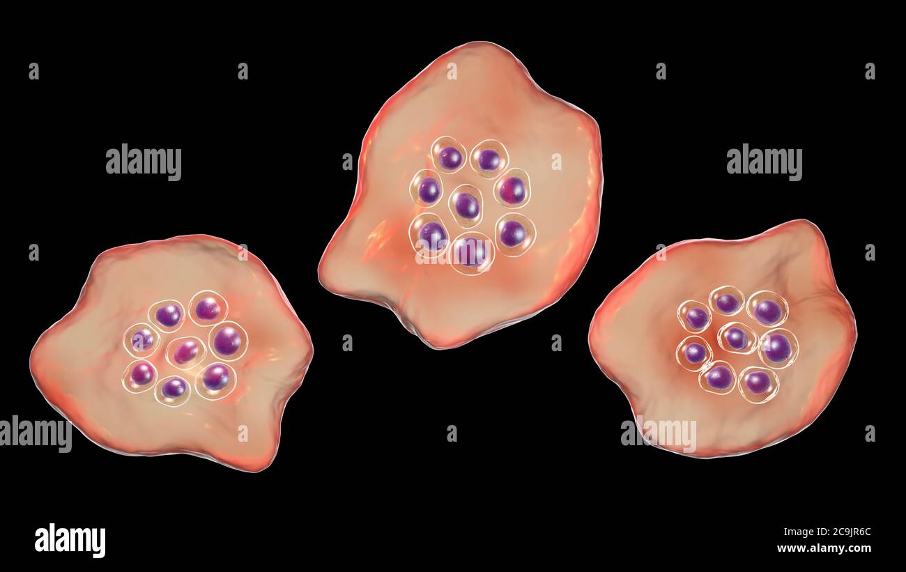 Plasmodium ovale protozoan inside red blood cell, computer illustration ...
