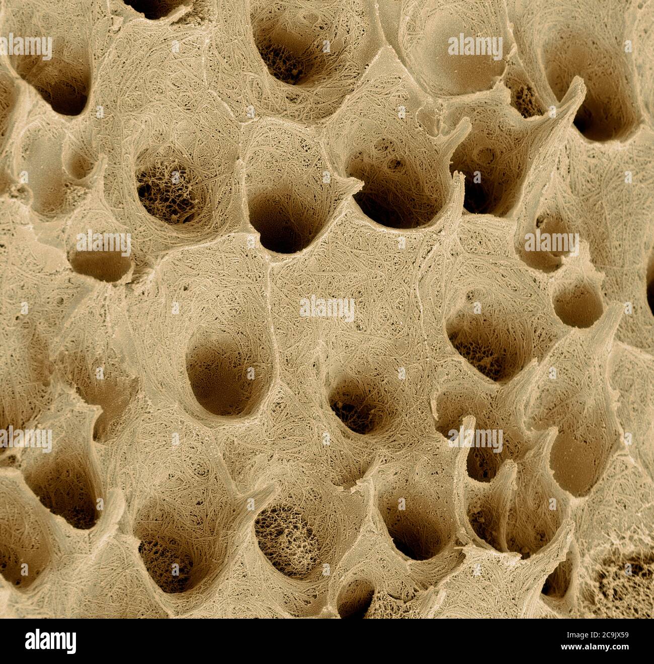 Tooth dentine. Coloured scanning electron micrograph (SEM) of dentine ...