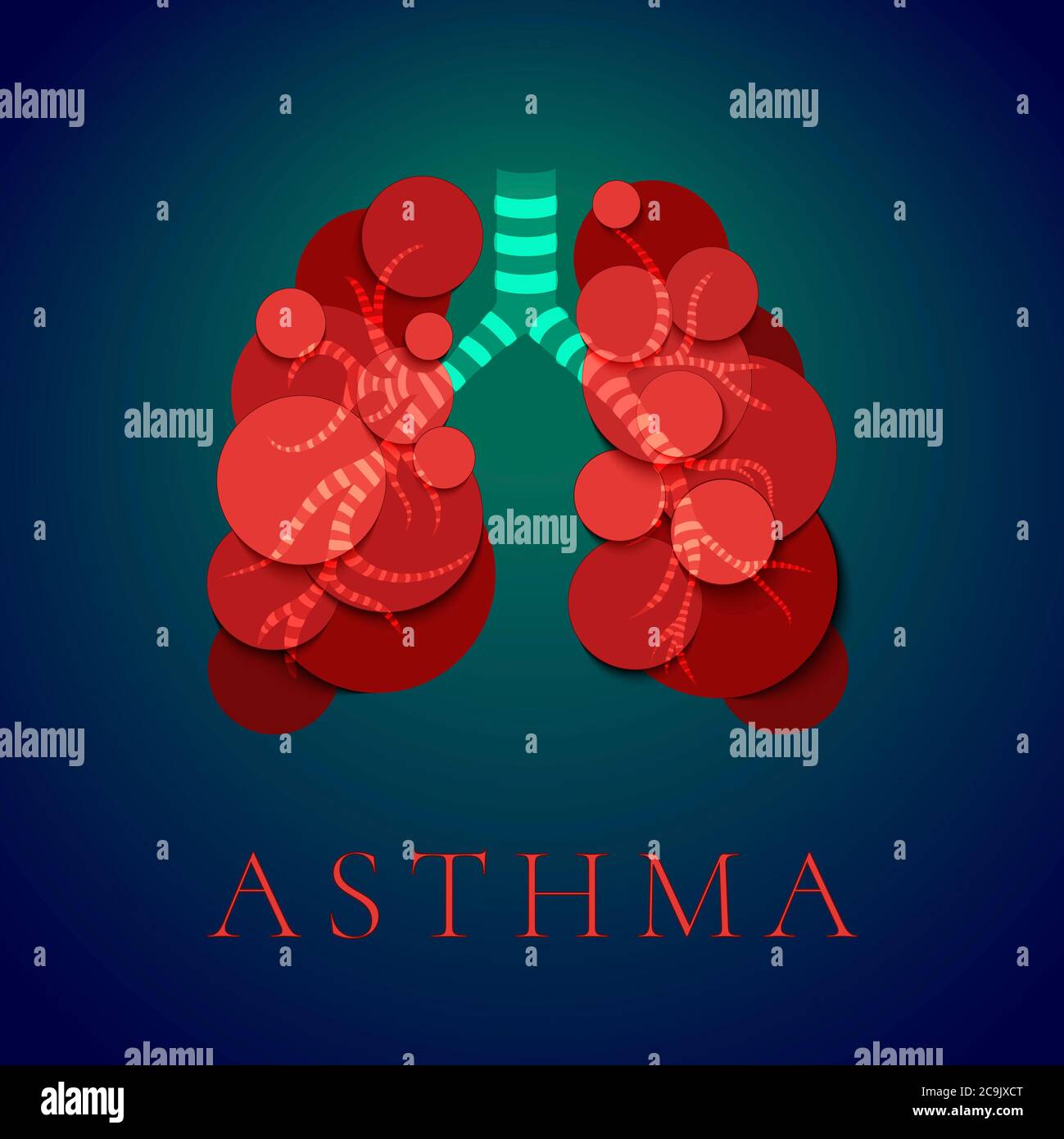 Asthma awareness, conceptual illustration Stock Photo - Alamy