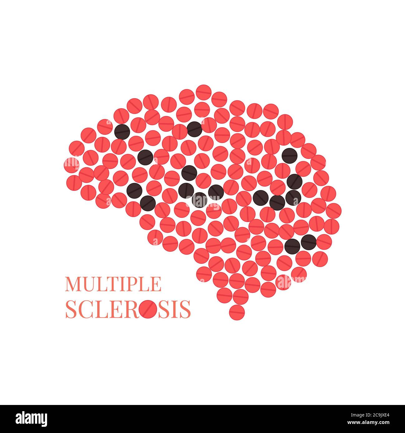 Multiple sclerosis, conceptual illustration Stock Photo - Alamy