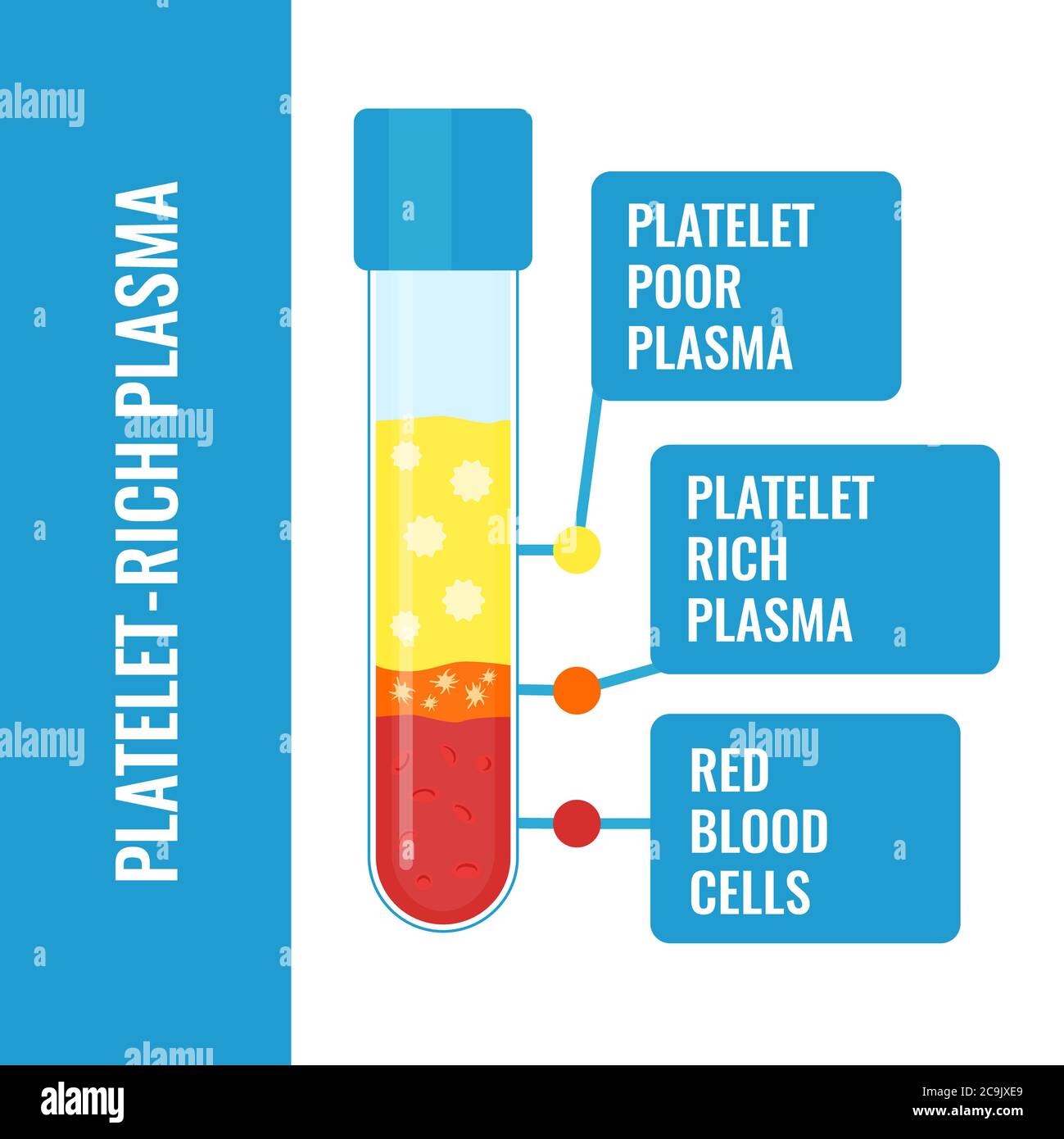 Platelet-rich plasma (PRP) composition, illustration Stock Photo - Alamy