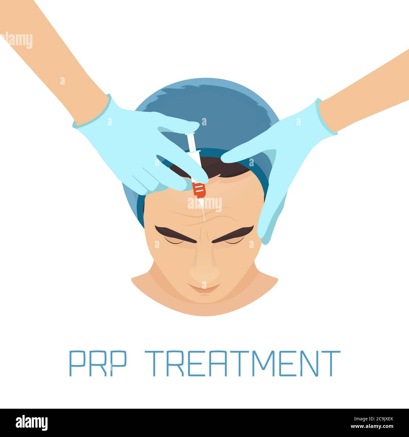 อันดับหนึ่ง 90+ ภาพพื้นหลัง ฉีด Prp ผม Pantip ครบถ้วน