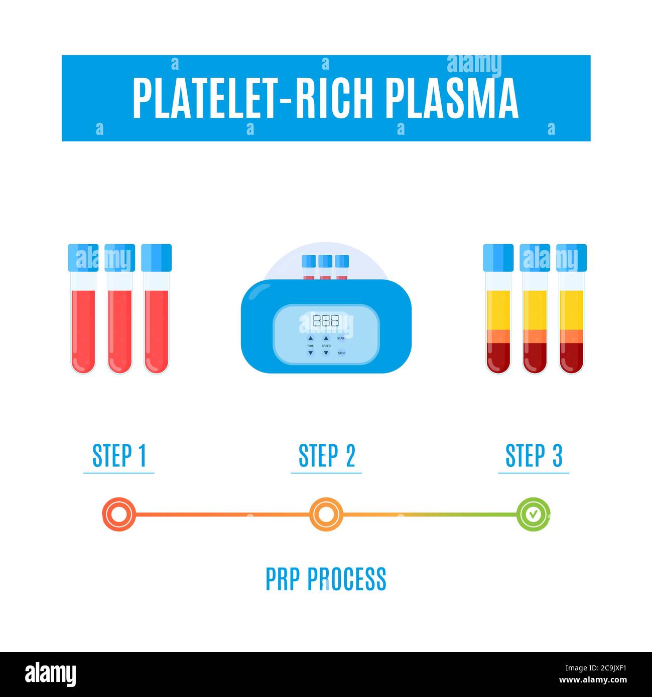 Platelet-rich plasma (PRP) procedure, illustration Stock Photo - Alamy
