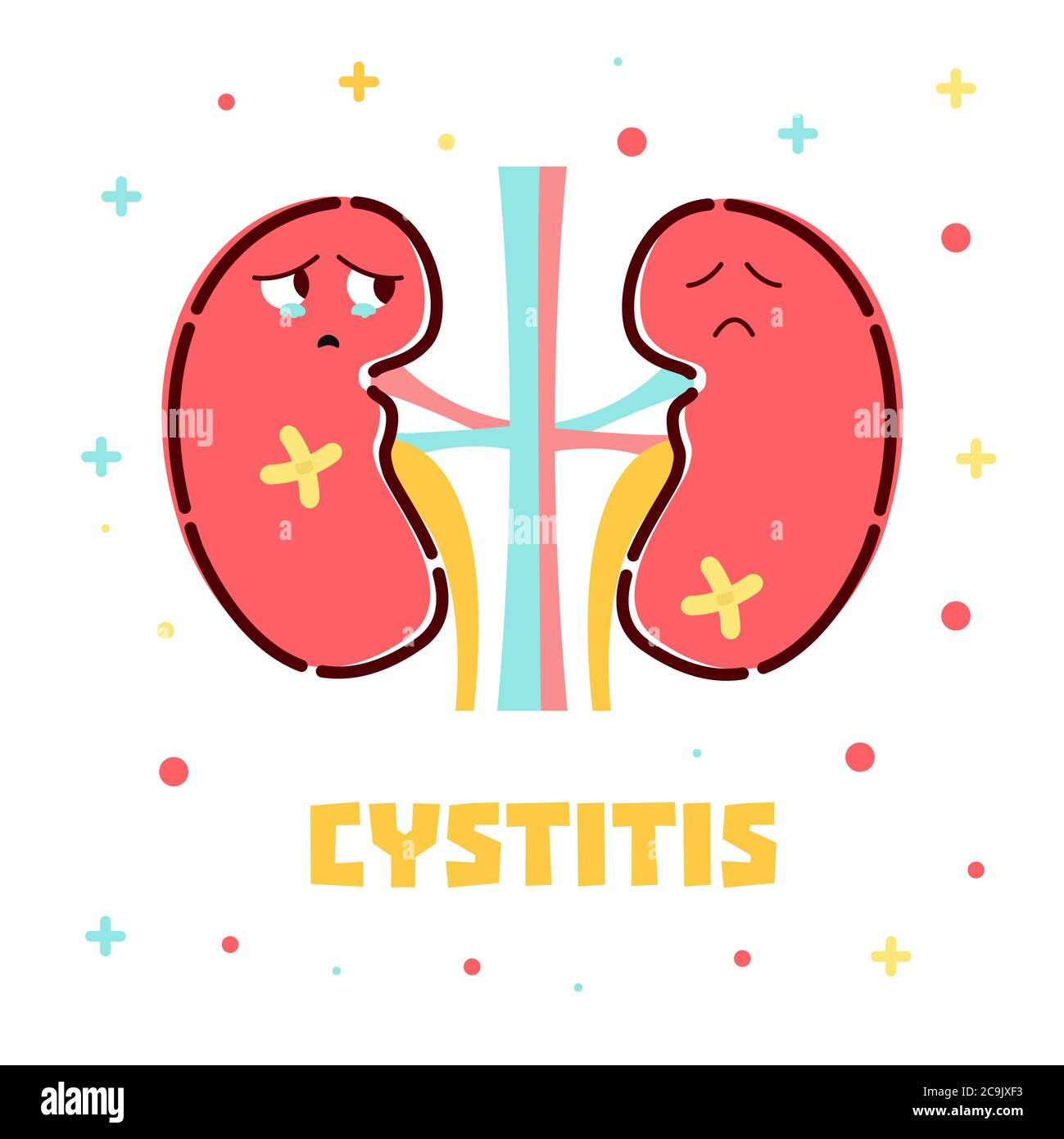 Cystitis, conceptual illustration Stock Photo - Alamy