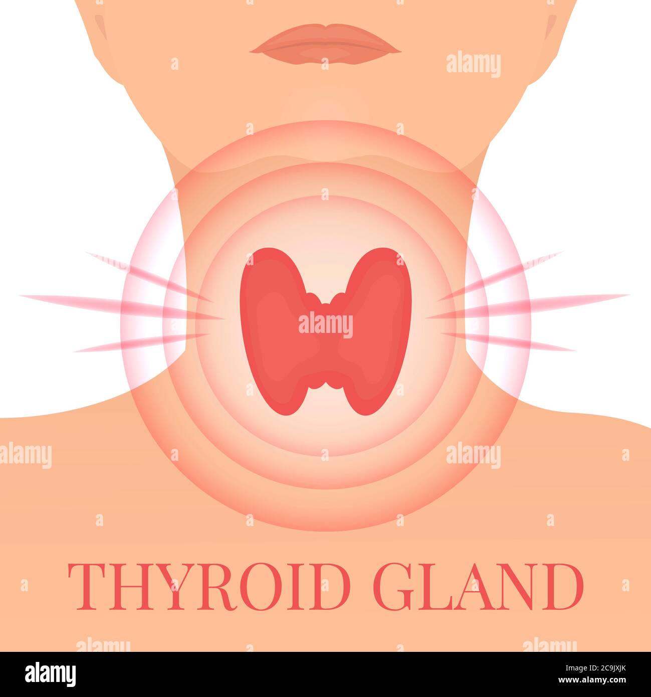 Thyroid gland disease, conceptual illustration Stock Photo - Alamy