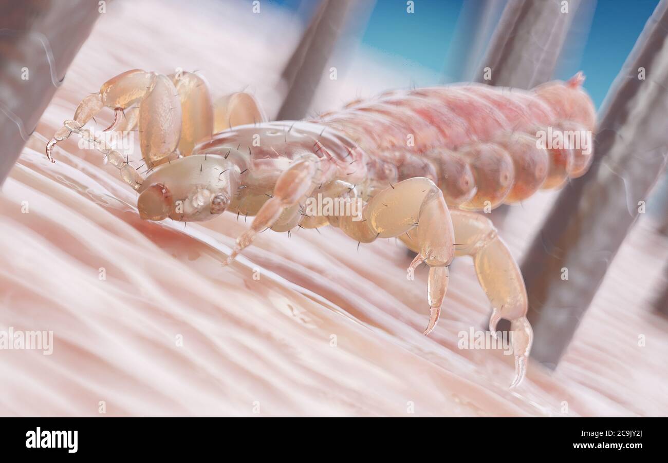 Head louse, computer illustration Stock Photo - Alamy