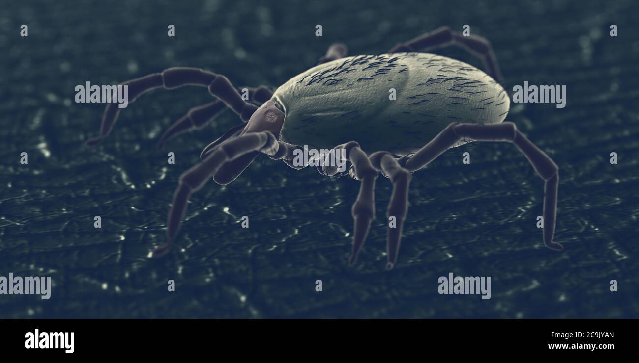 Tick on human skin, computer illustration Stock Photo - Alamy