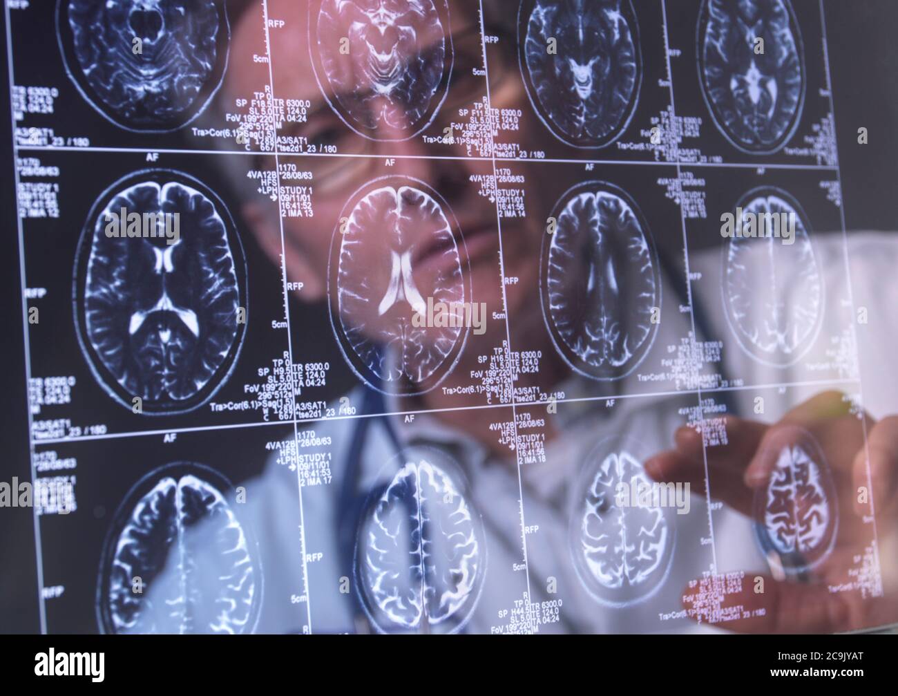 Doctor viewing a human brain scan on a screen in a neurology clinic ...