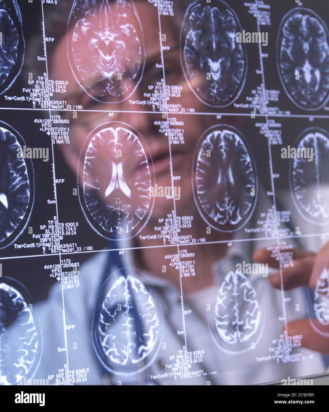 Doctor viewing a human brain scan on a screen in a neurology clinic ...