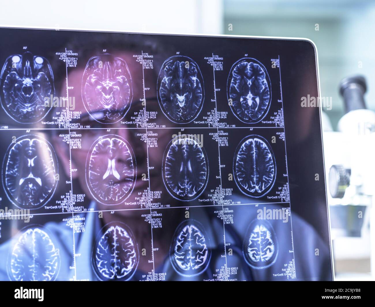 Doctor viewing a human brain scan on a screen in a neurology clinic ...