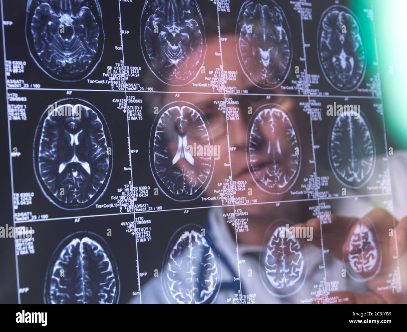Doctor viewing a human brain scan on a screen in a neurology clinic ...