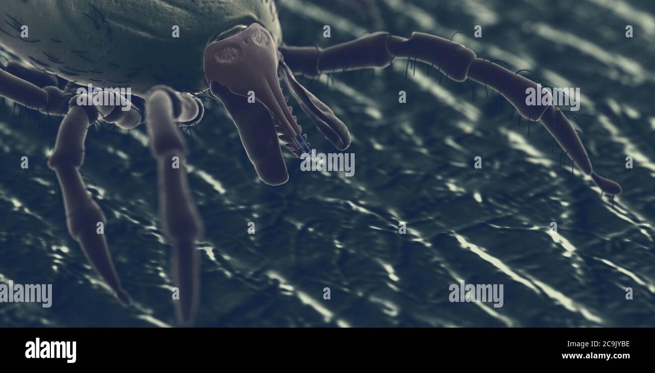Tick on human skin, computer illustration Stock Photo - Alamy