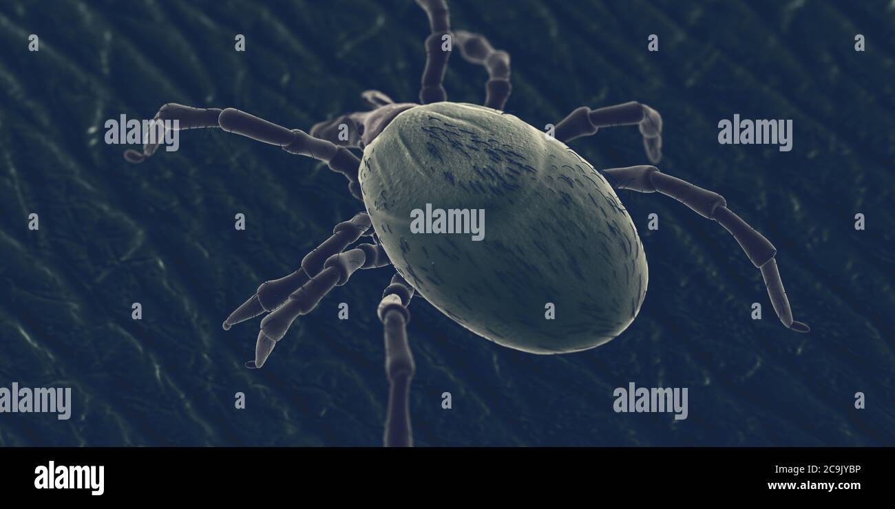 Tick on human skin, computer illustration Stock Photo - Alamy