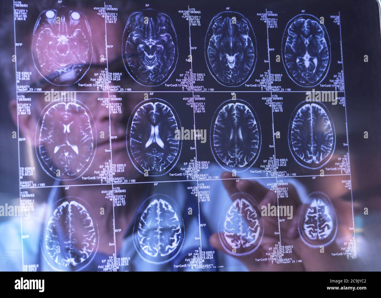 Doctor viewing a human brain scan on a screen in a neurology clinic ...