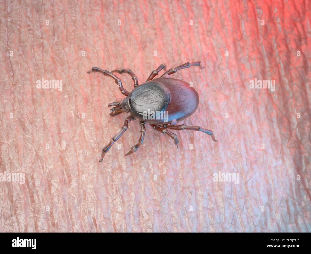 Tick on human skin, computer illustration Stock Photo - Alamy