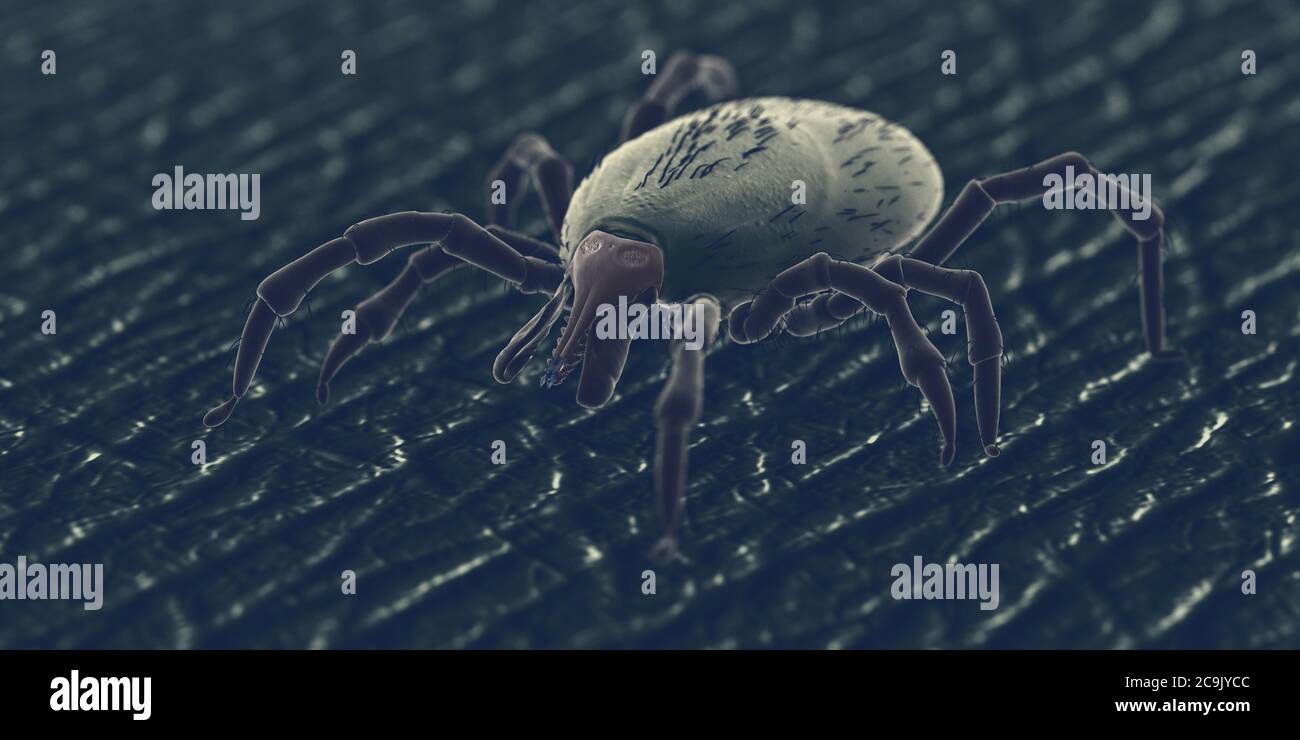 Tick on human skin, computer illustration Stock Photo - Alamy
