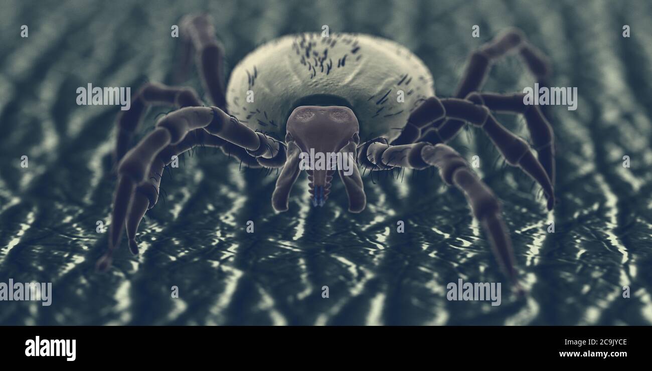 Tick on human skin, computer illustration Stock Photo - Alamy