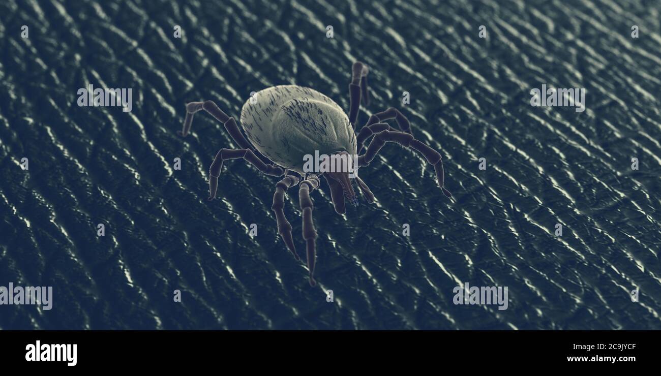 Tick on human skin, computer illustration Stock Photo - Alamy