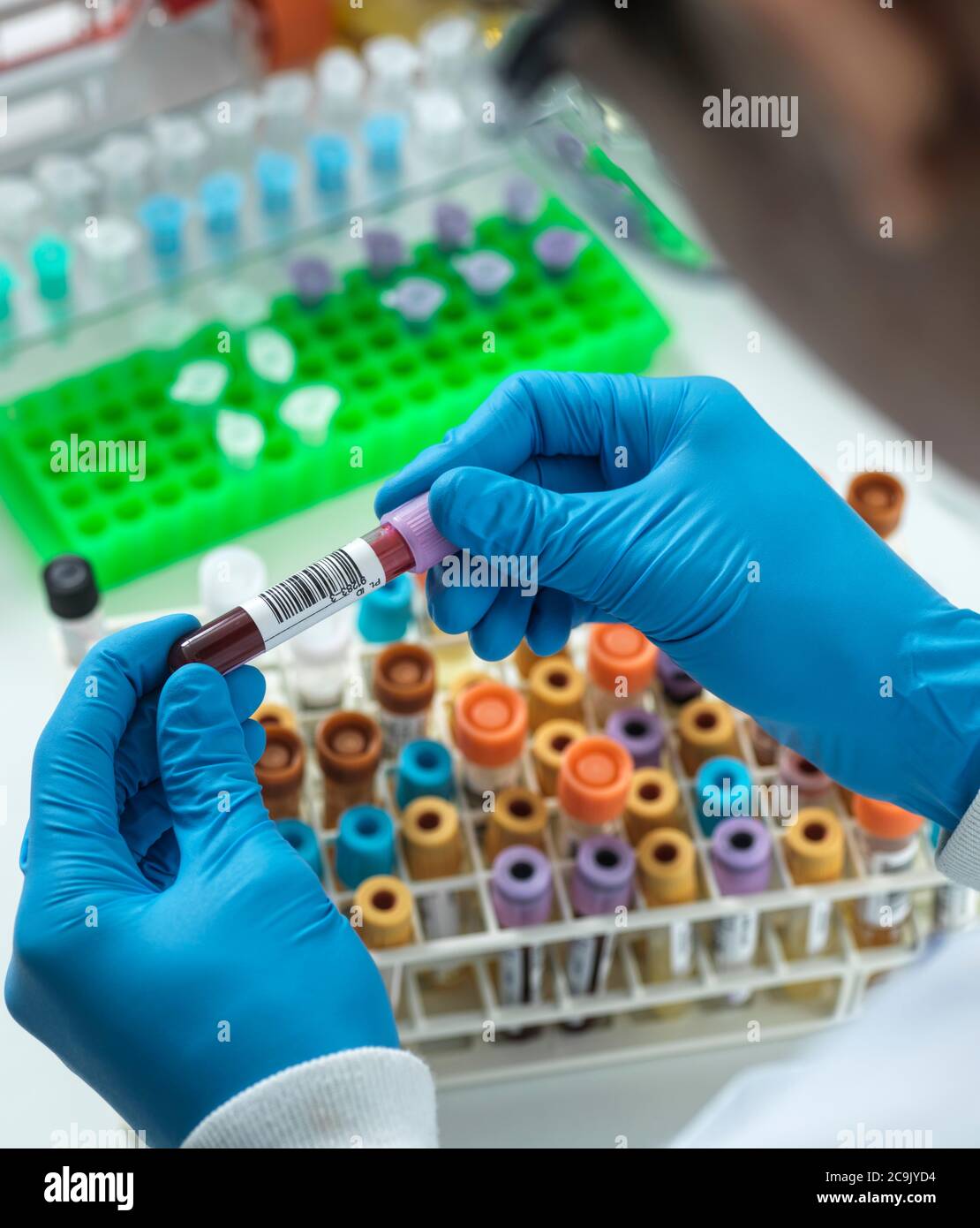 Technician preparing human medical samples for screening Stock Photo ...