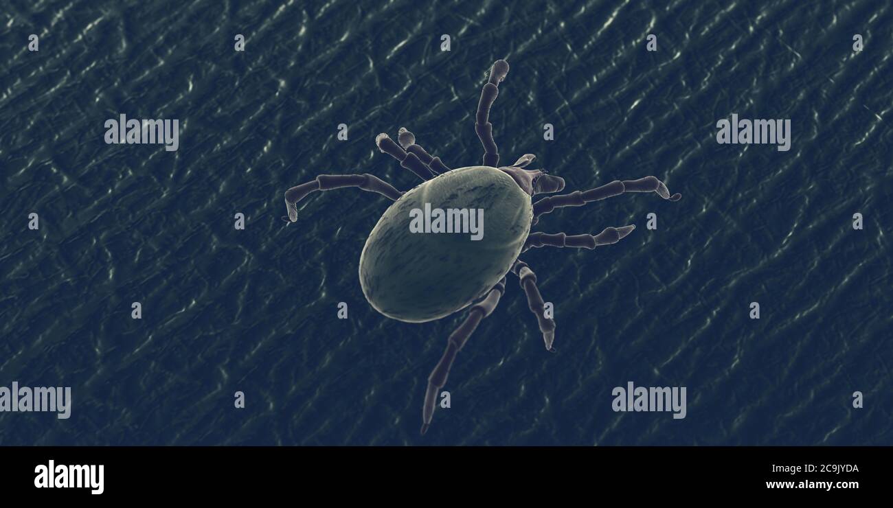 Tick on human skin, computer illustration Stock Photo - Alamy