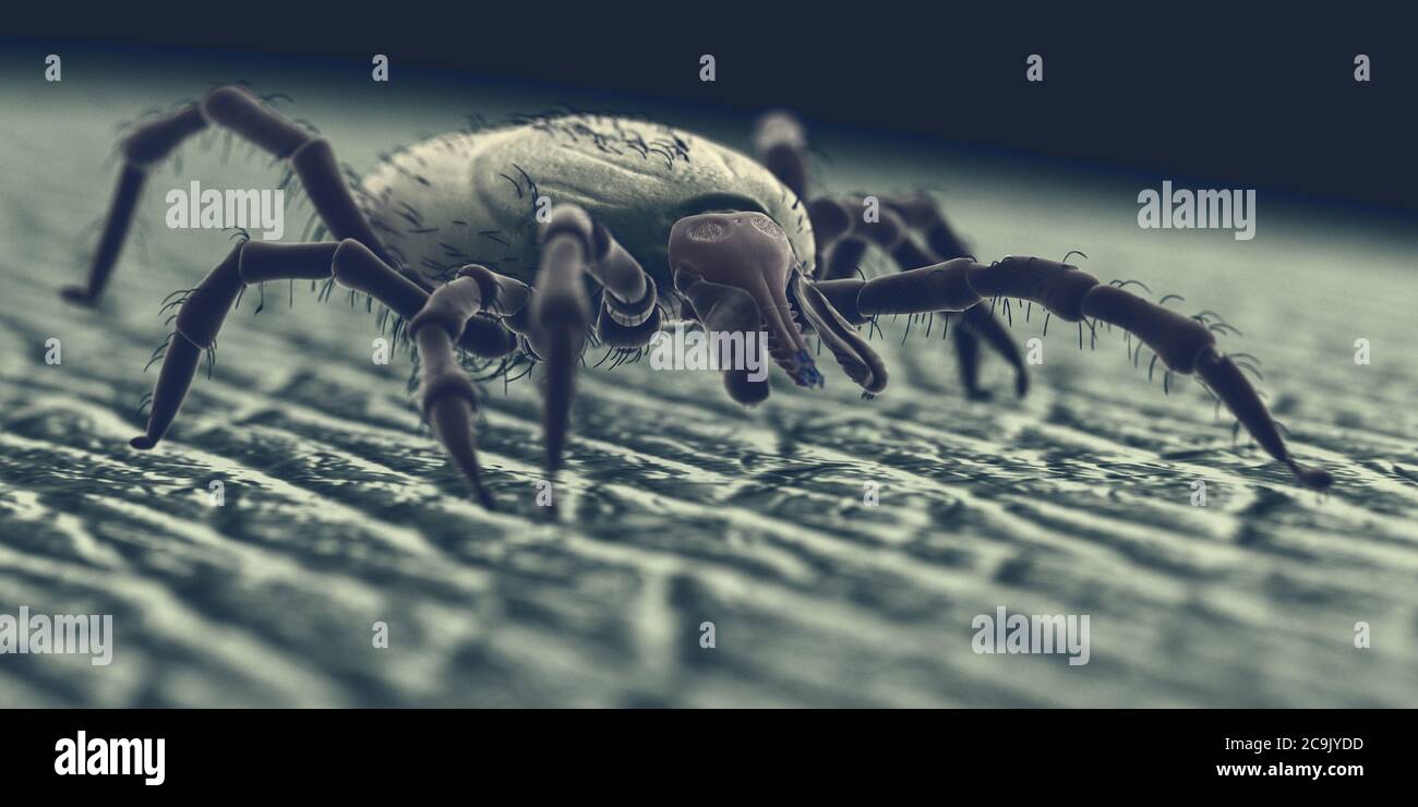 Tick on human skin, computer illustration Stock Photo - Alamy