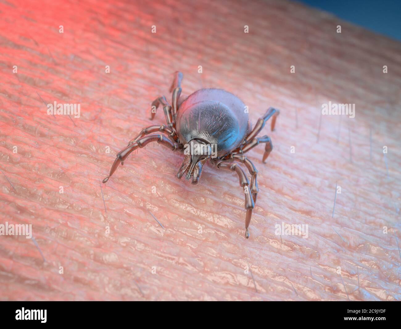 Tick on human skin, computer illustration Stock Photo - Alamy