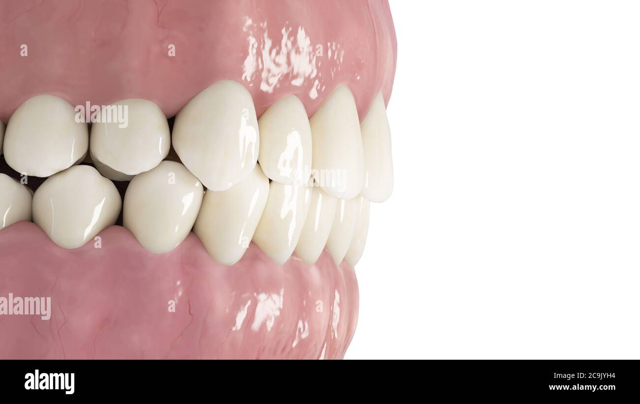 Human teeth, illustration Stock Photo - Alamy