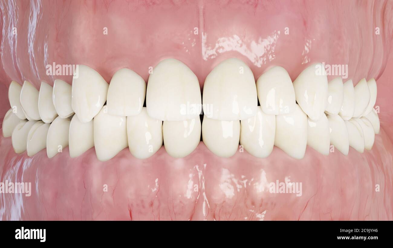 Human teeth, illustration Stock Photo - Alamy