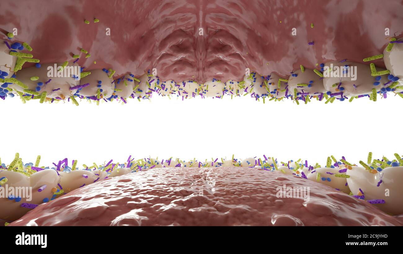 Teeth bacteria hi-res stock photography and images - Alamy