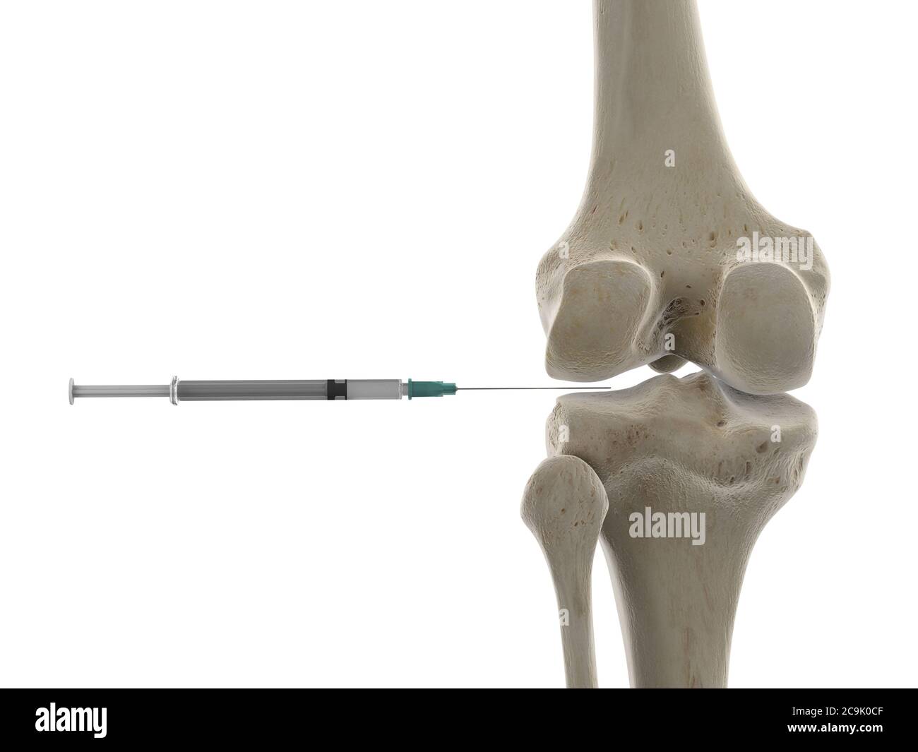 Knee injection Cut Out Stock Images & Pictures - Alamy