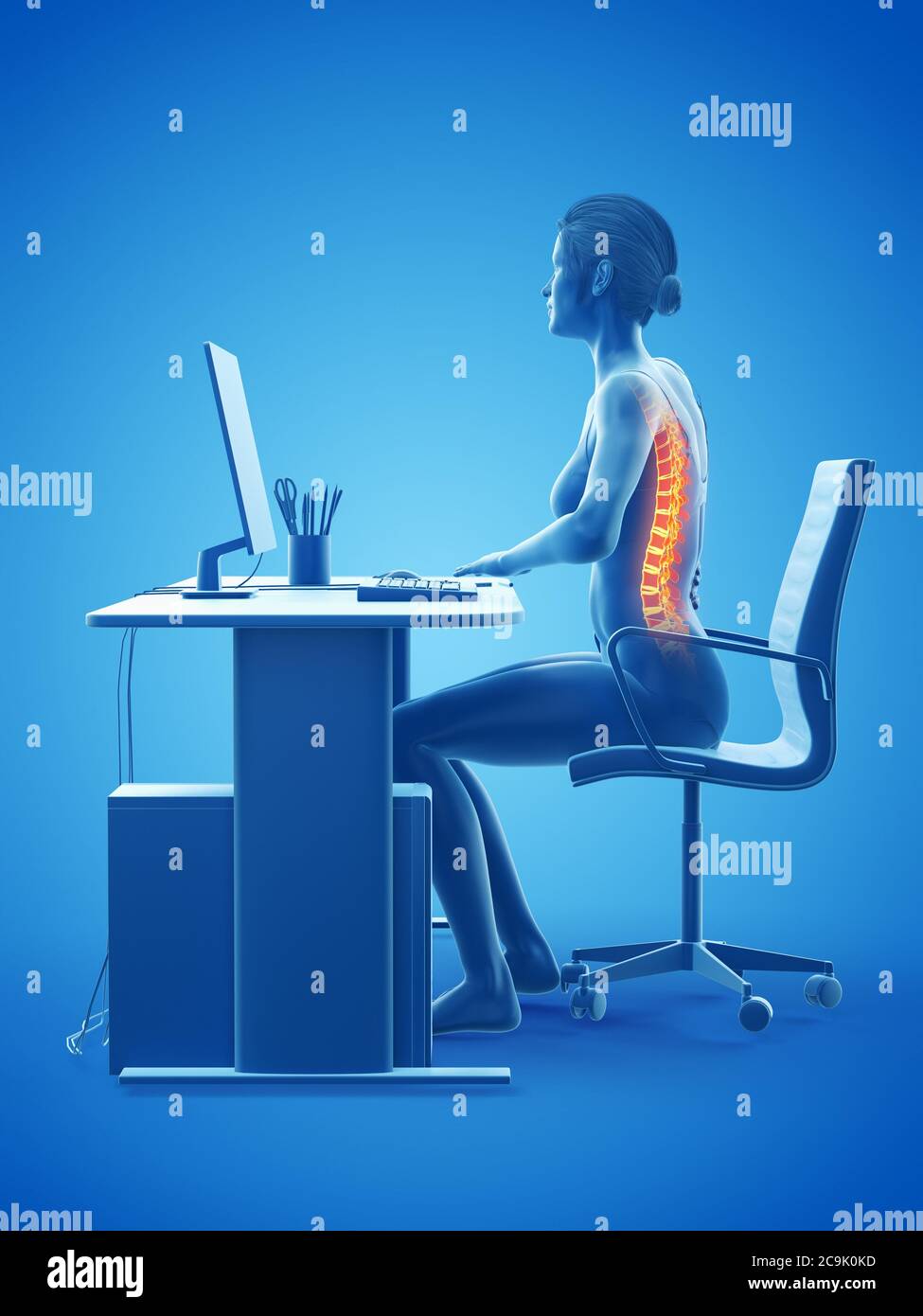 Backache woman graphic hi-res stock photography and images - Alamy