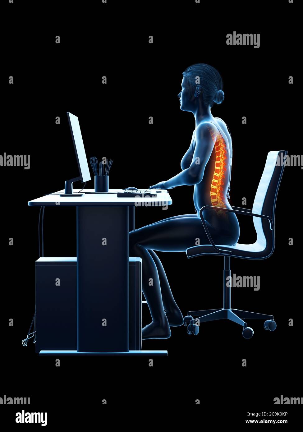 Woman with backache, illustration Stock Photo - Alamy