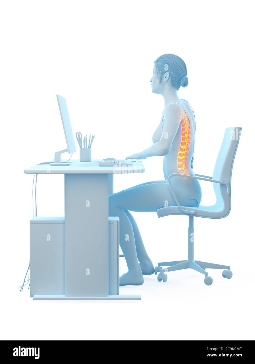 Backache woman graphic hi-res stock photography and images - Alamy