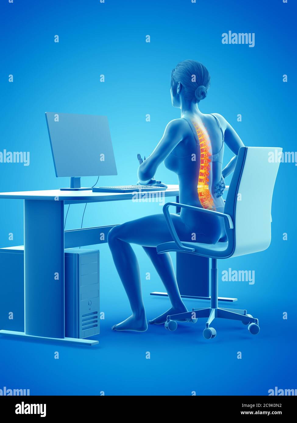 Backache illustration woman hi-res stock photography and images - Alamy