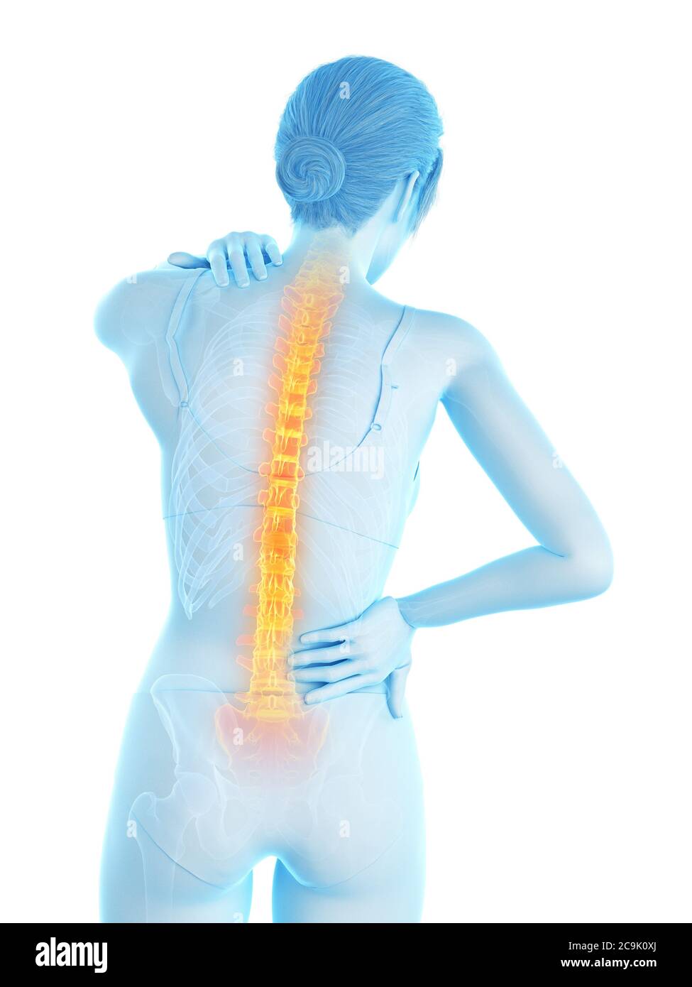Woman with backache, illustration Stock Photo - Alamy