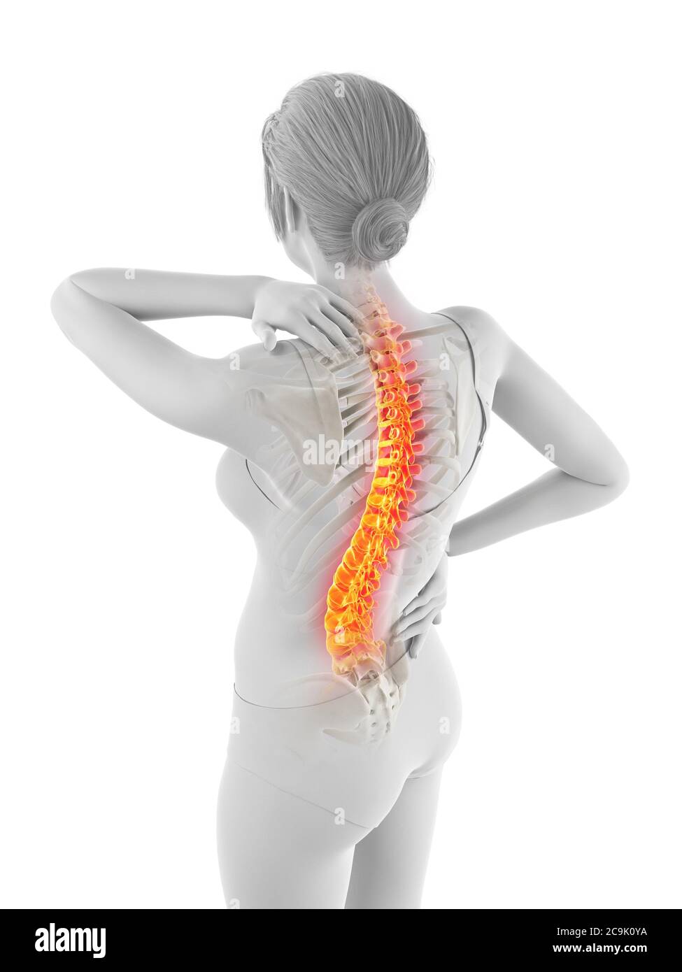 Woman with backache, illustration Stock Photo - Alamy