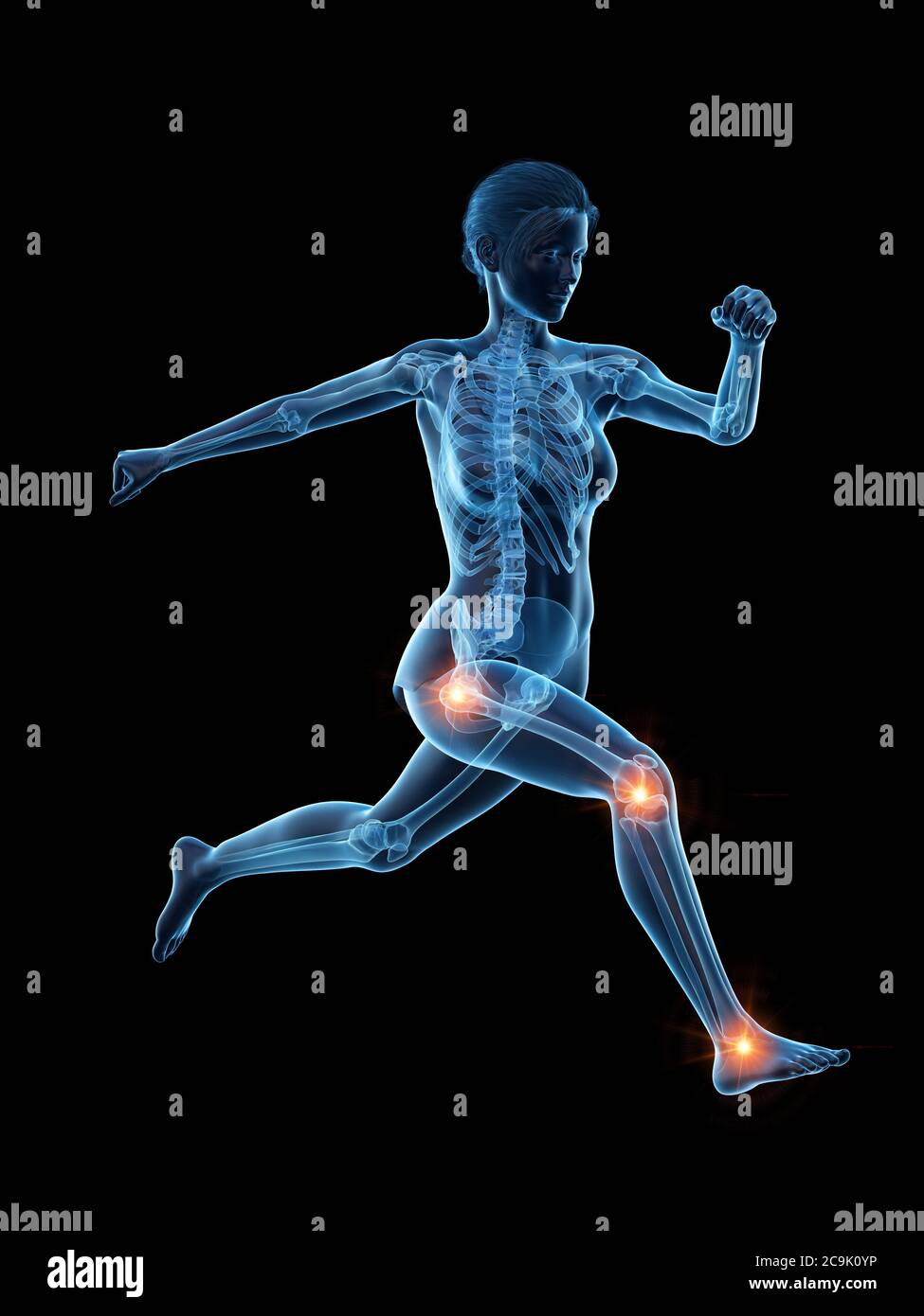 Woman with painful joints while running, illustration Stock Photo - Alamy
