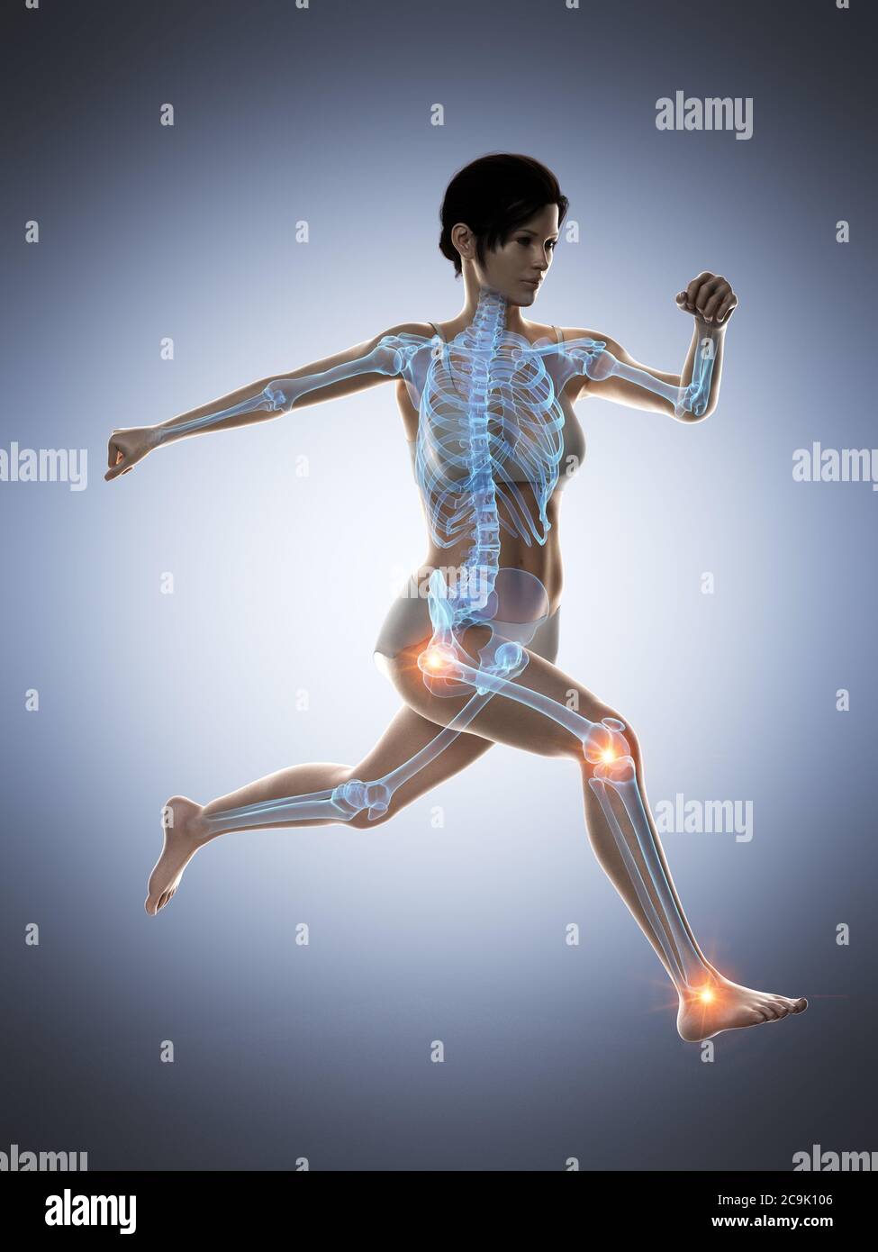 Woman with painful joints while running, illustration Stock Photo - Alamy