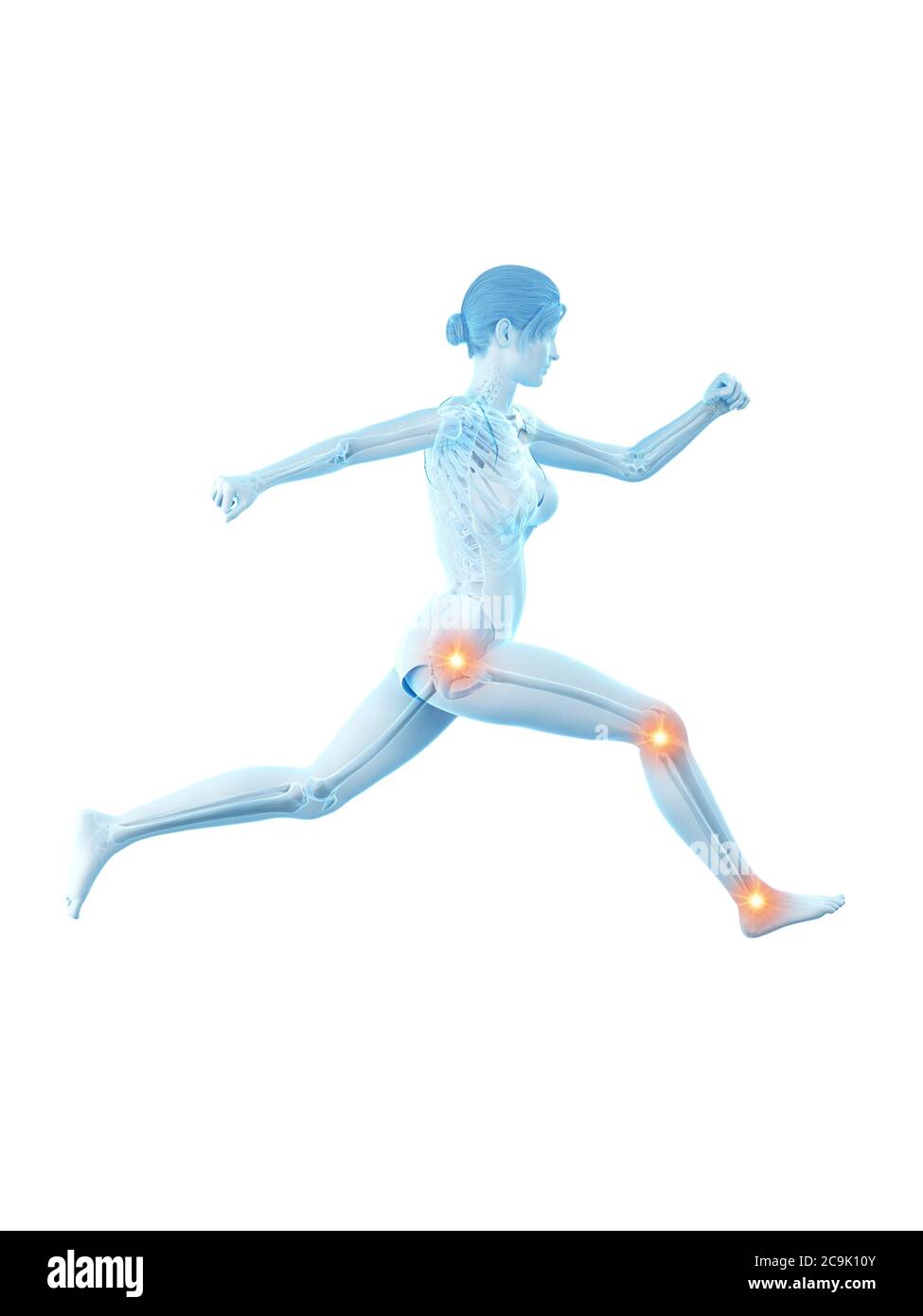 Woman with painful joints while running, illustration Stock Photo - Alamy