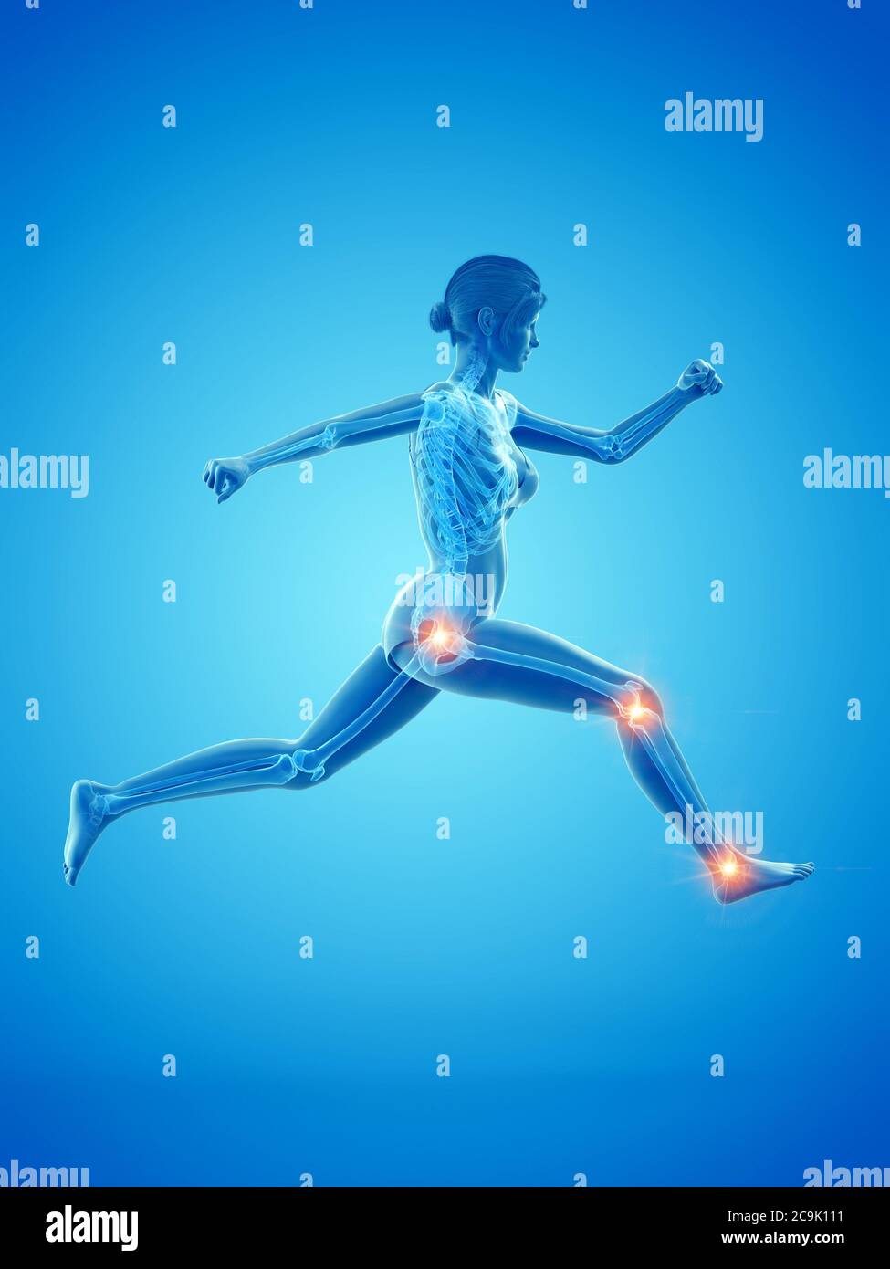 Woman with painful joints while running, illustration Stock Photo - Alamy