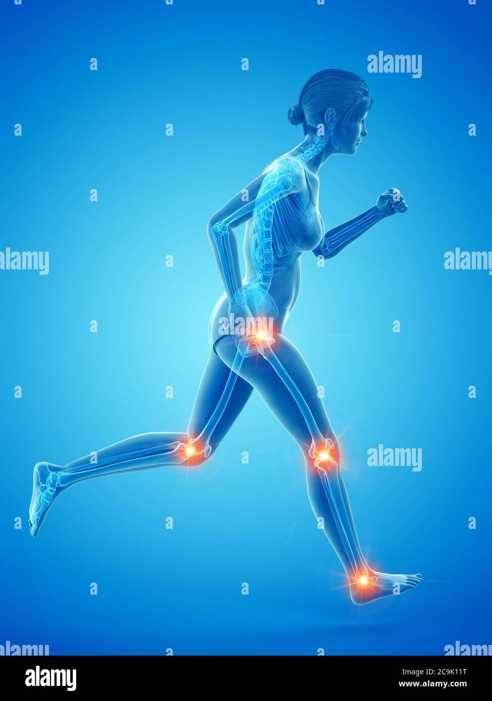 Woman with painful joints while running, illustration Stock Photo - Alamy