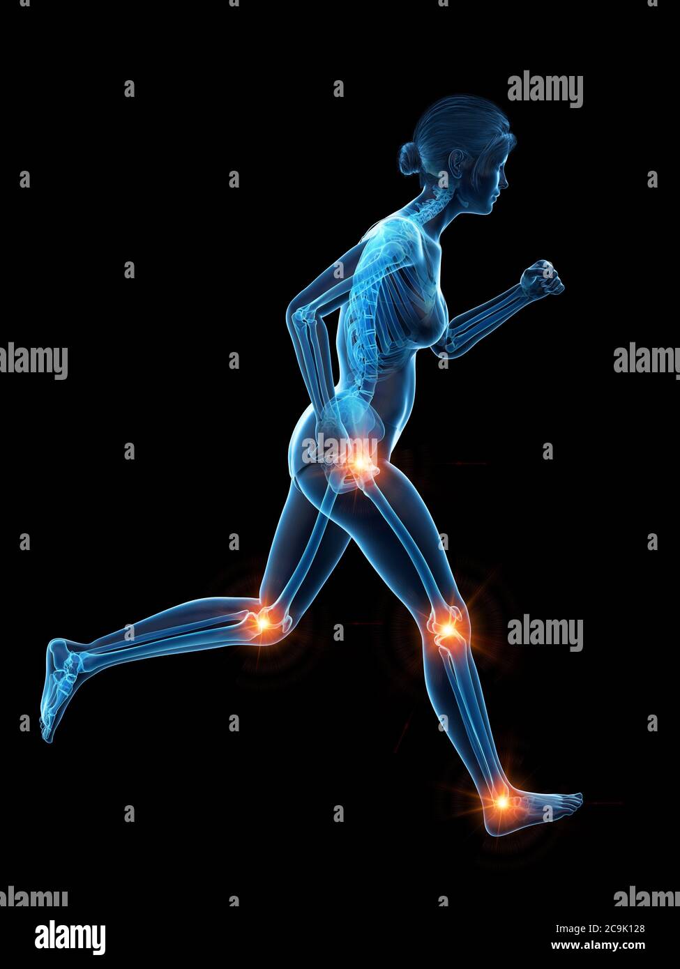 Woman with painful joints while running, illustration Stock Photo - Alamy