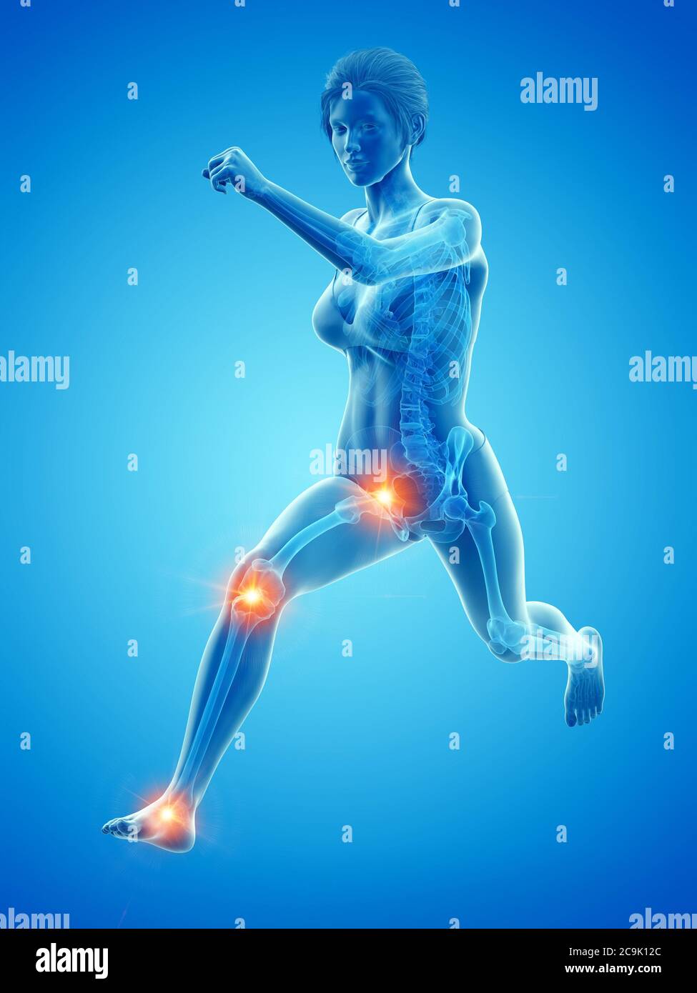 Woman with painful joints while running, illustration Stock Photo - Alamy