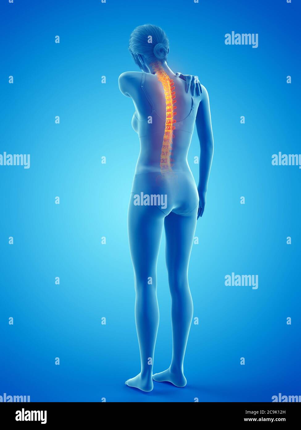 Woman with backache, illustration Stock Photo - Alamy