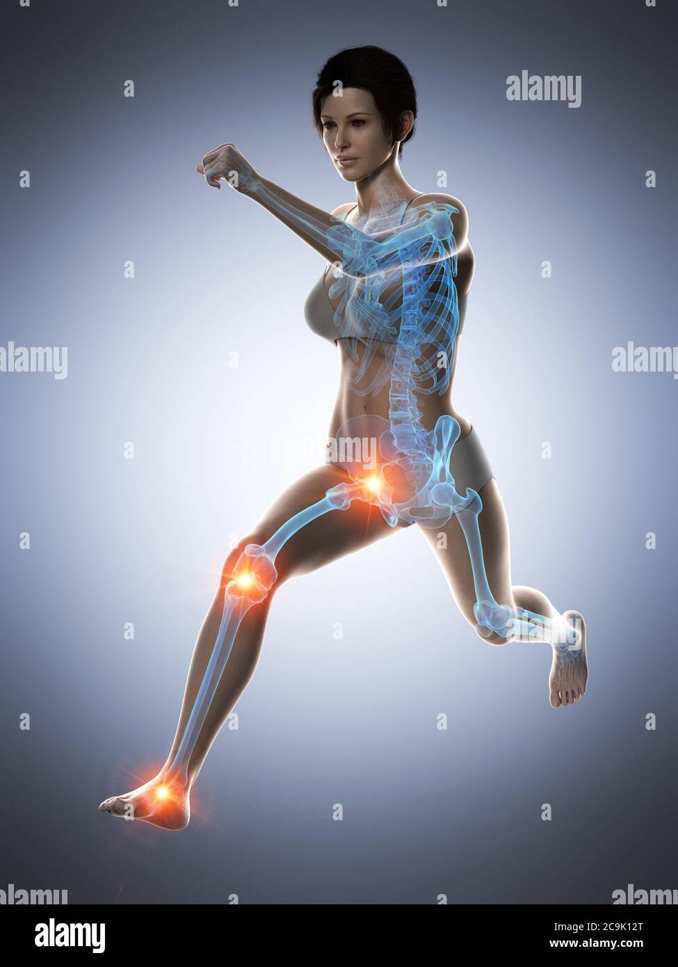 Woman with painful joints while running, illustration Stock Photo - Alamy