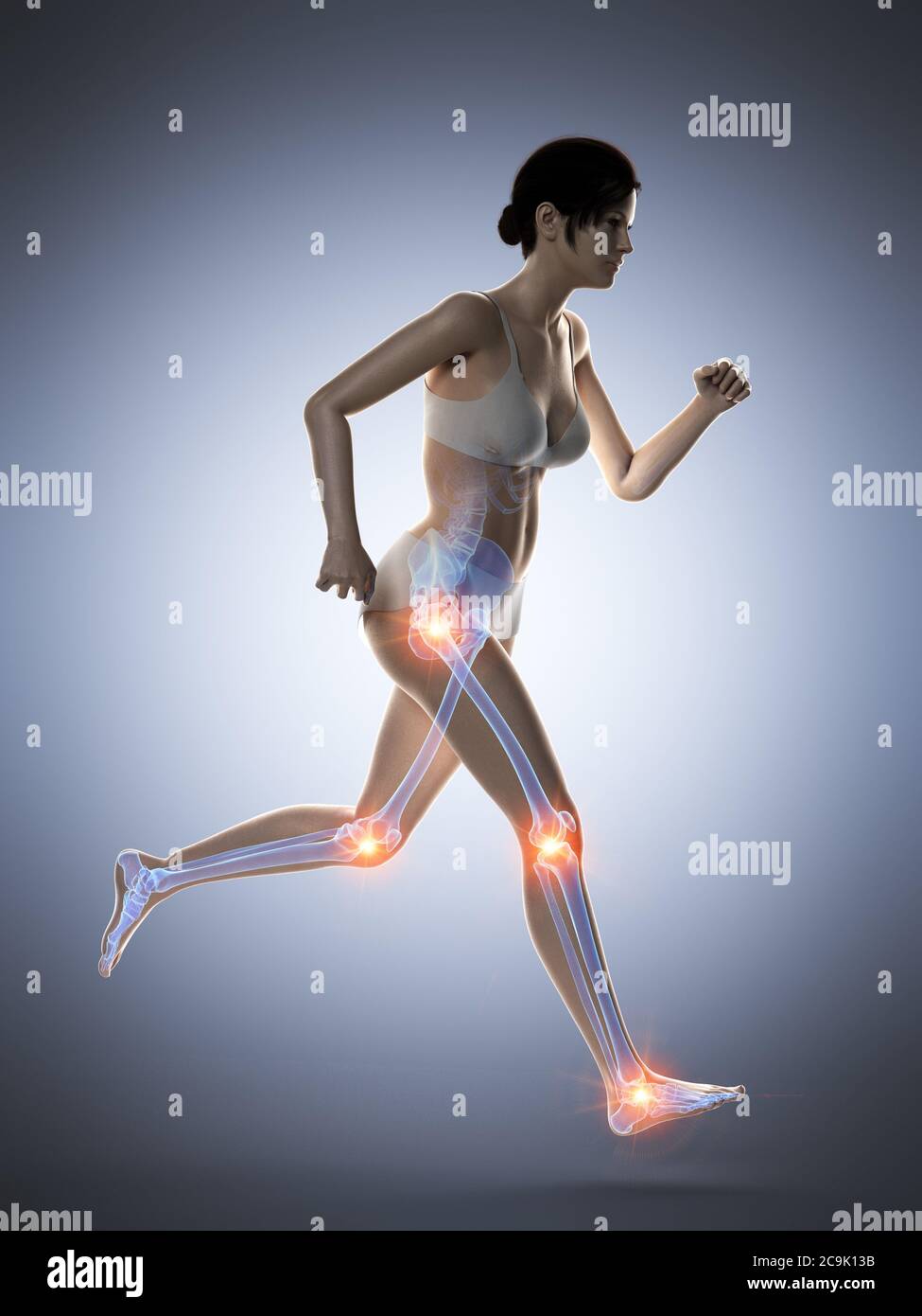Woman with painful joints while running, illustration Stock Photo - Alamy