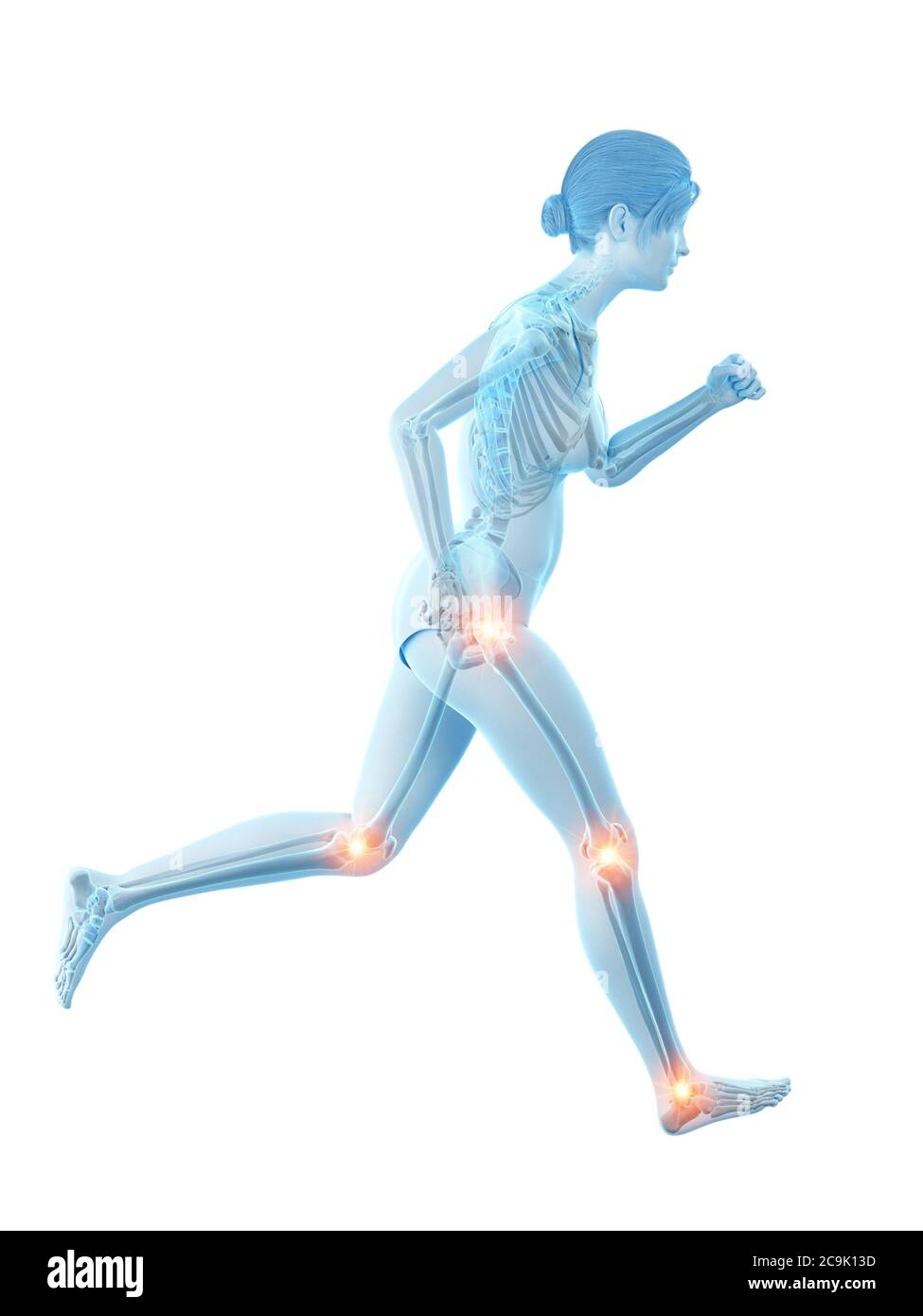 Woman with painful joints while running, illustration Stock Photo - Alamy