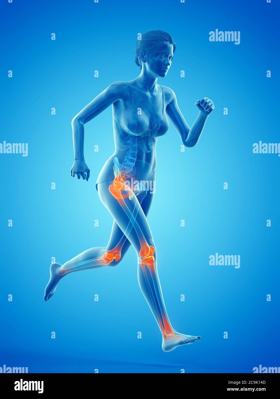 Woman with painful joints while running, illustration Stock Photo - Alamy