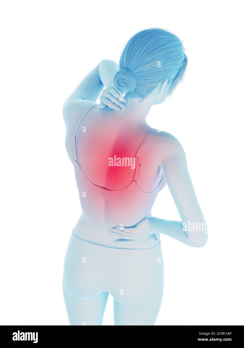 Woman with backache, illustration Stock Photo - Alamy